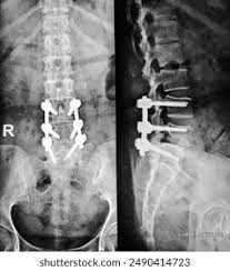 Surgery is Scheduled for December 15 – Renée Gaubert, LCSW